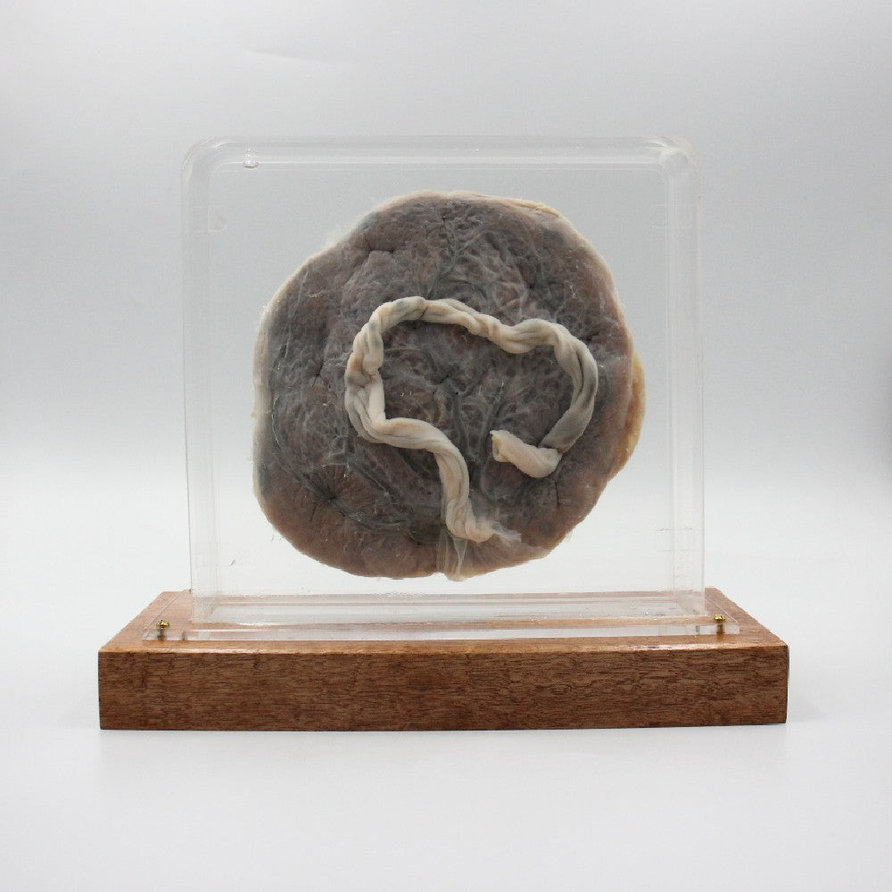 Placenta Preservation - Rest in Pieces