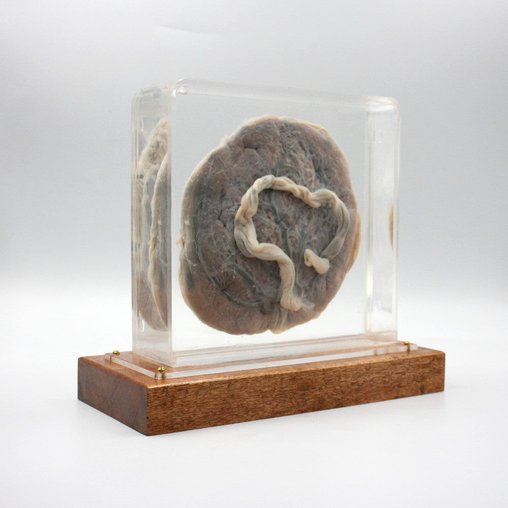 Wet Preservation - Rest in Pieces